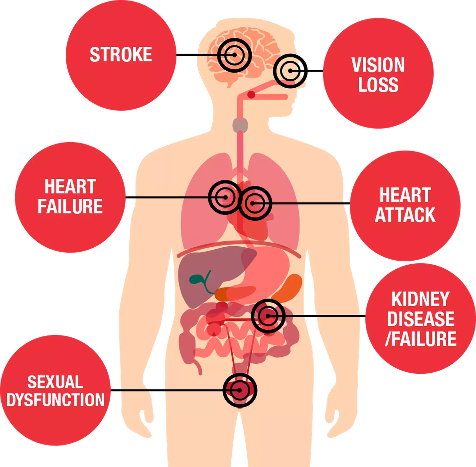 HYPERTENSION Healwell Primary Care
